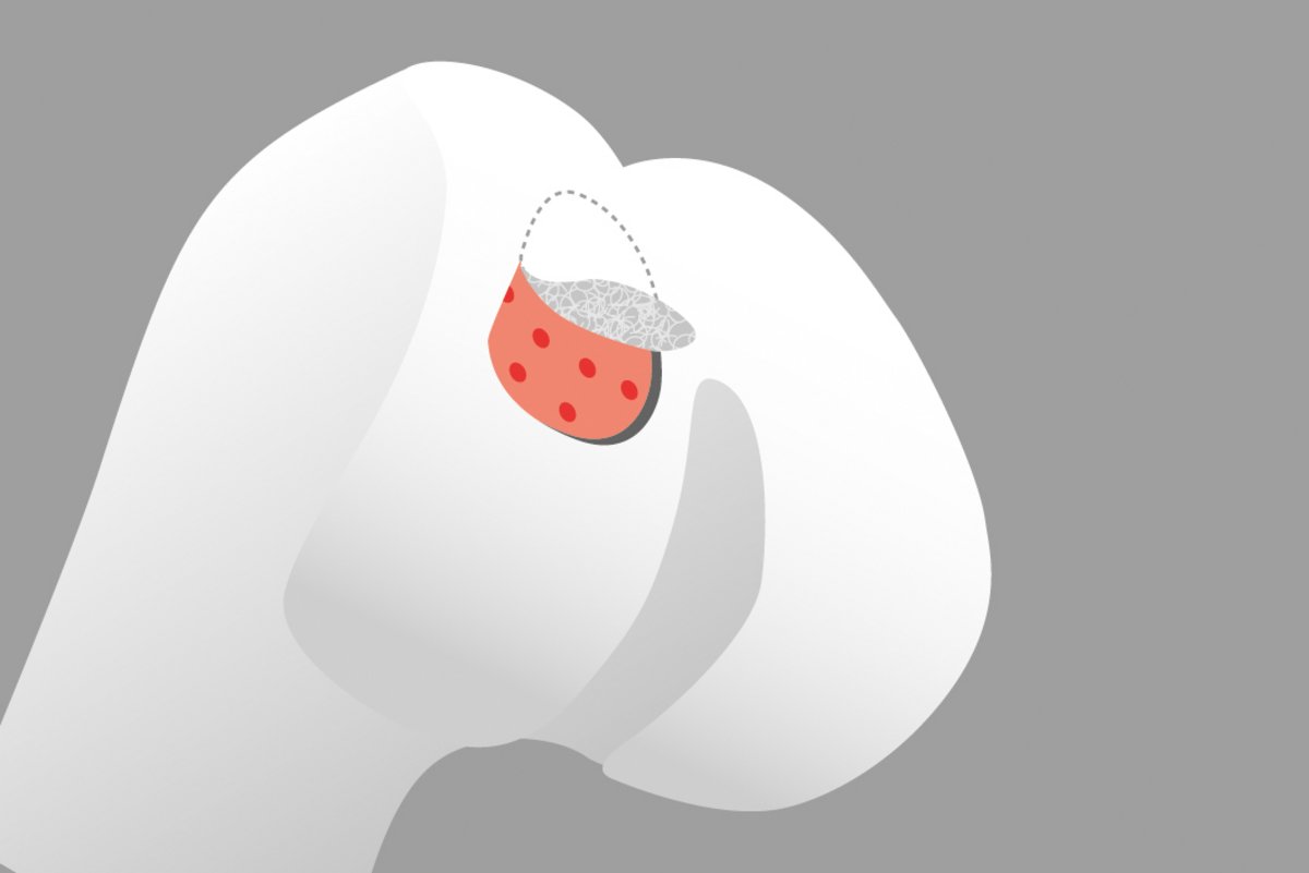 About AMIC - Geistlich Pharma AG