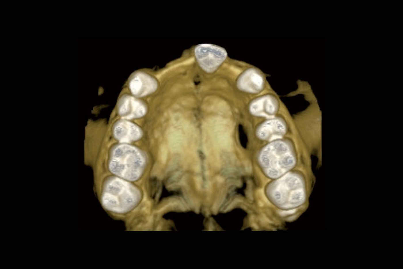 SafeScraper TWIST - Geistlich Pharma AG
