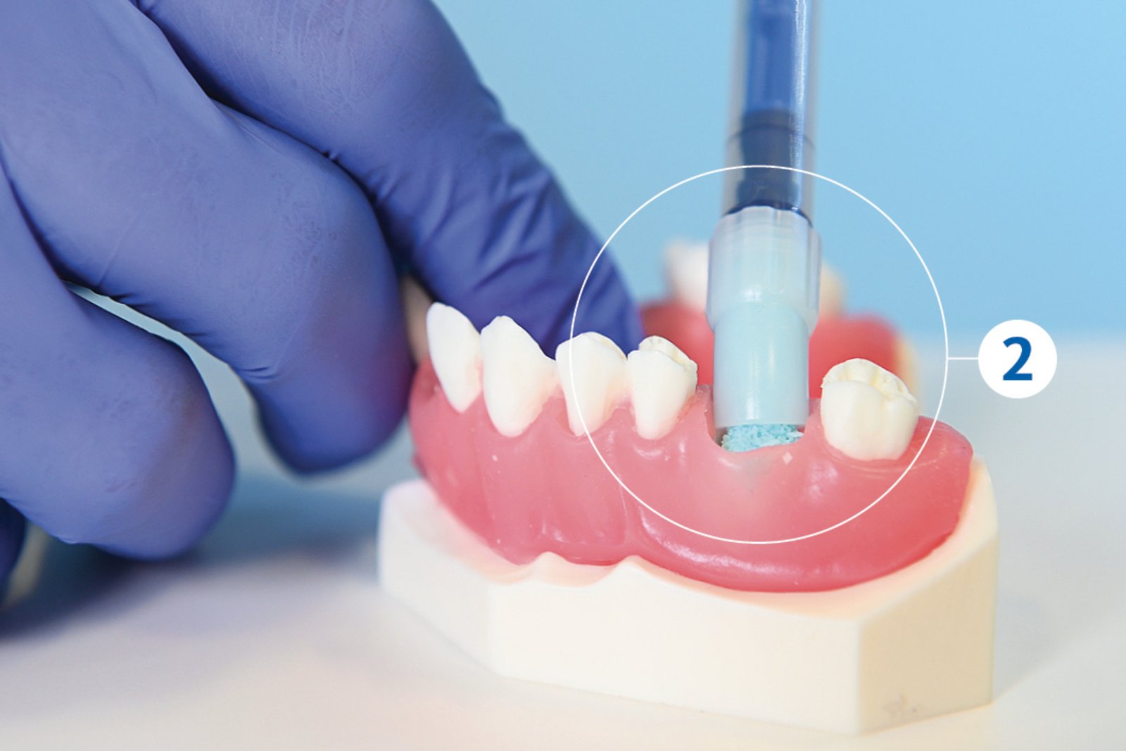 Geistlich Bio-Oss Pen - Geistlich Pharma AG