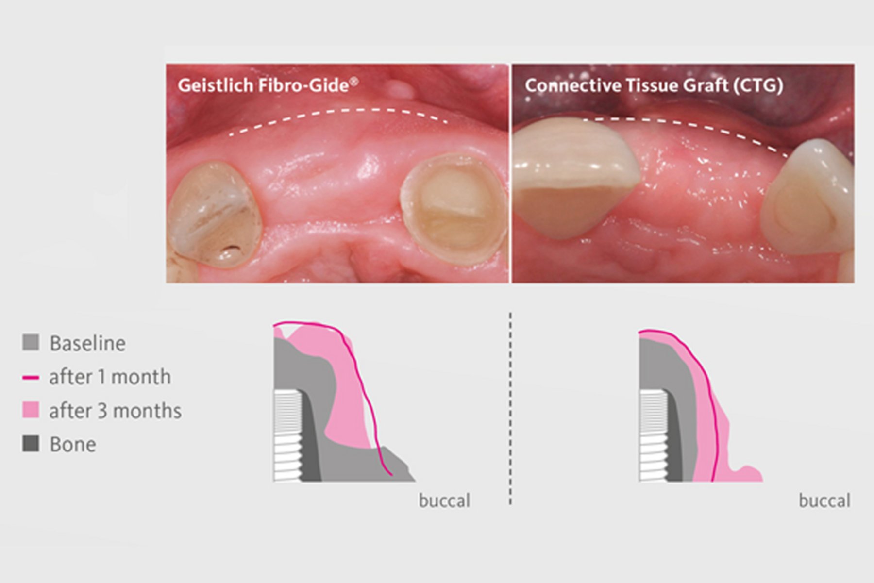 Fibro-Gide - Geistlich Pharma AG