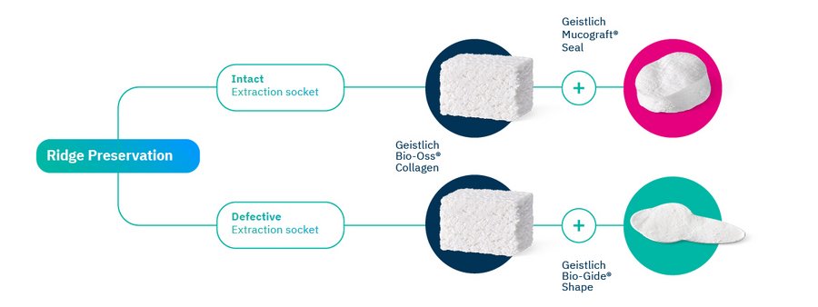 Ridge Preservation - Geistlich Pharma AG