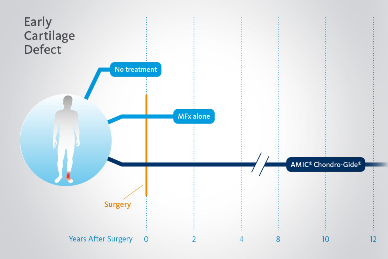 AMIC Talus - Geistlich Pharma AG