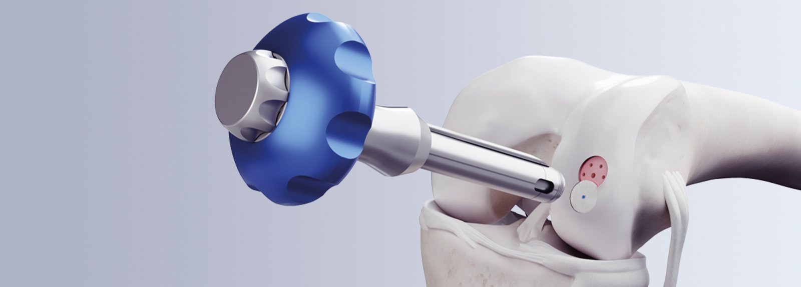 AMIC arthroscopic instruments - Geistlich Pharma AG