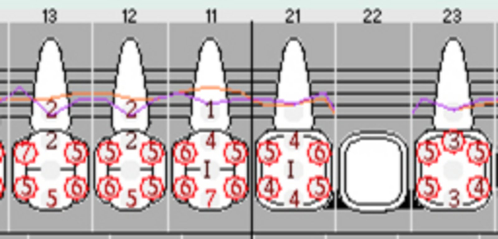 Transforming periodontal care with Pocket-X® Gel - Geistlich Pharma AG