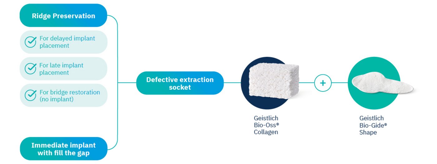 Geistlich Bio-Gide Shape - Geistlich Pharma AG