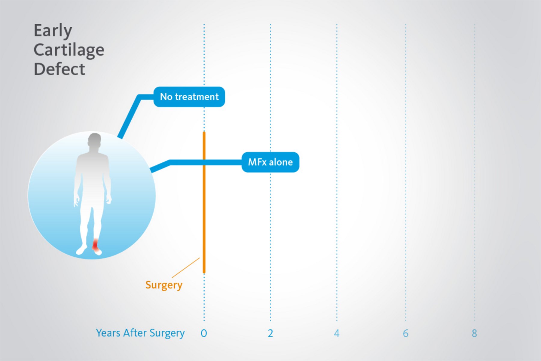 AMIC Talus - Geistlich Pharma AG
