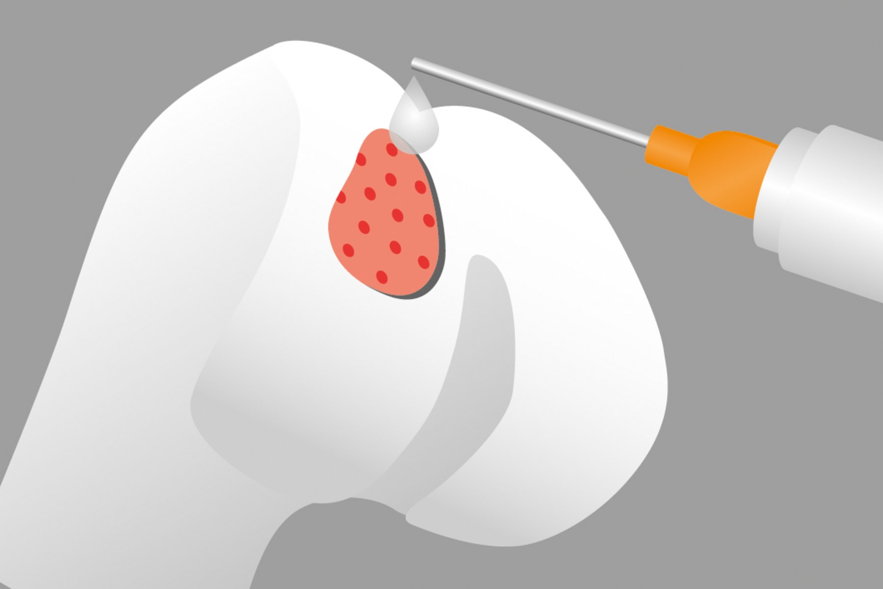 About AMIC - Geistlich Pharma AG