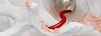 Orthoss - Geistlich Pharma AG