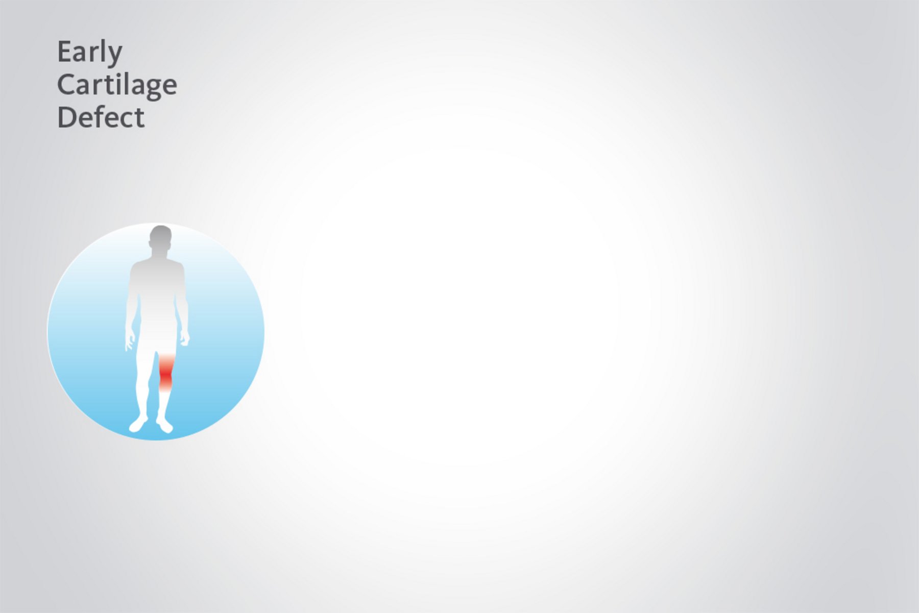 AMIC Knee - Geistlich Pharma AG