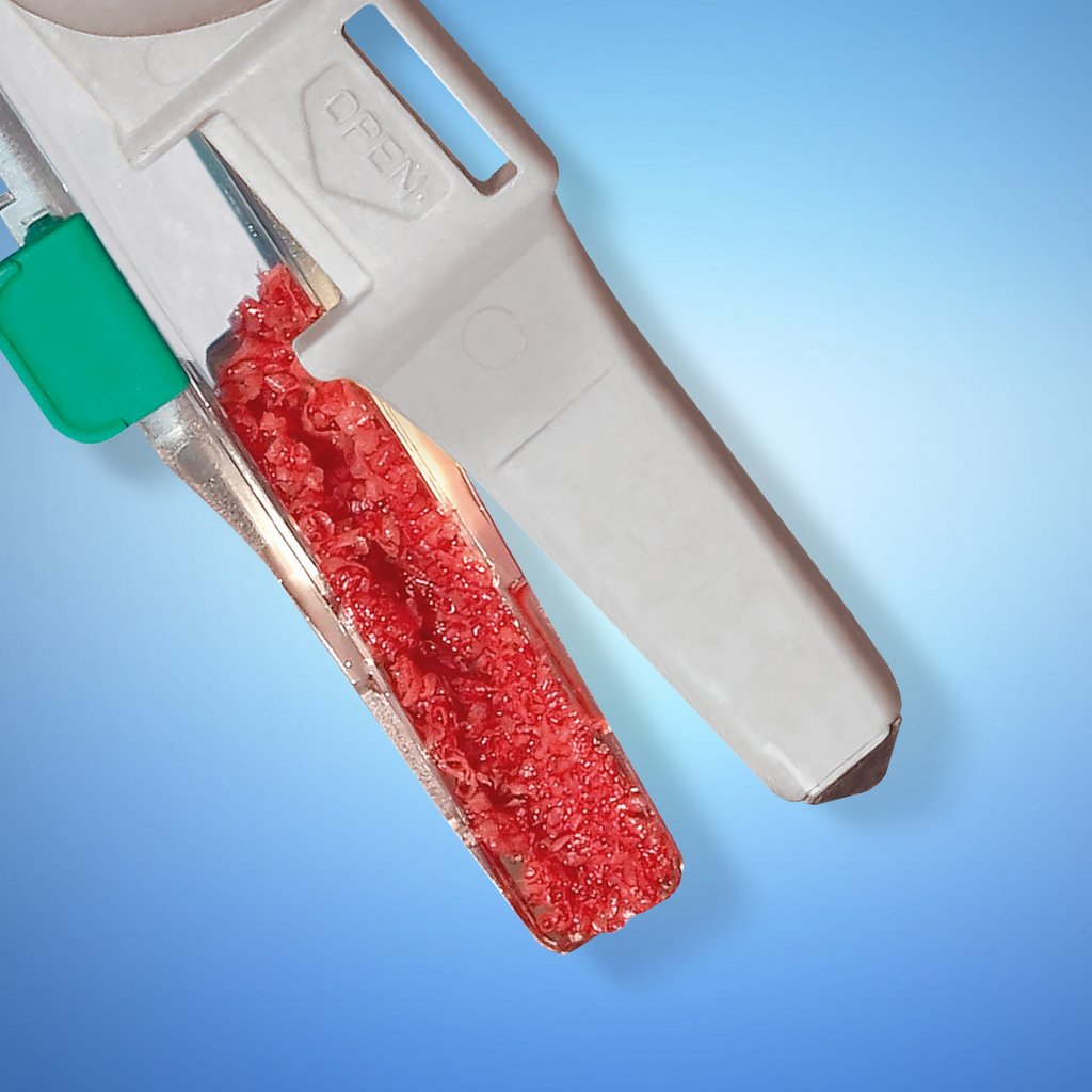 Safescraper Twist Curve Volumizer - Geistlich Pharma AG