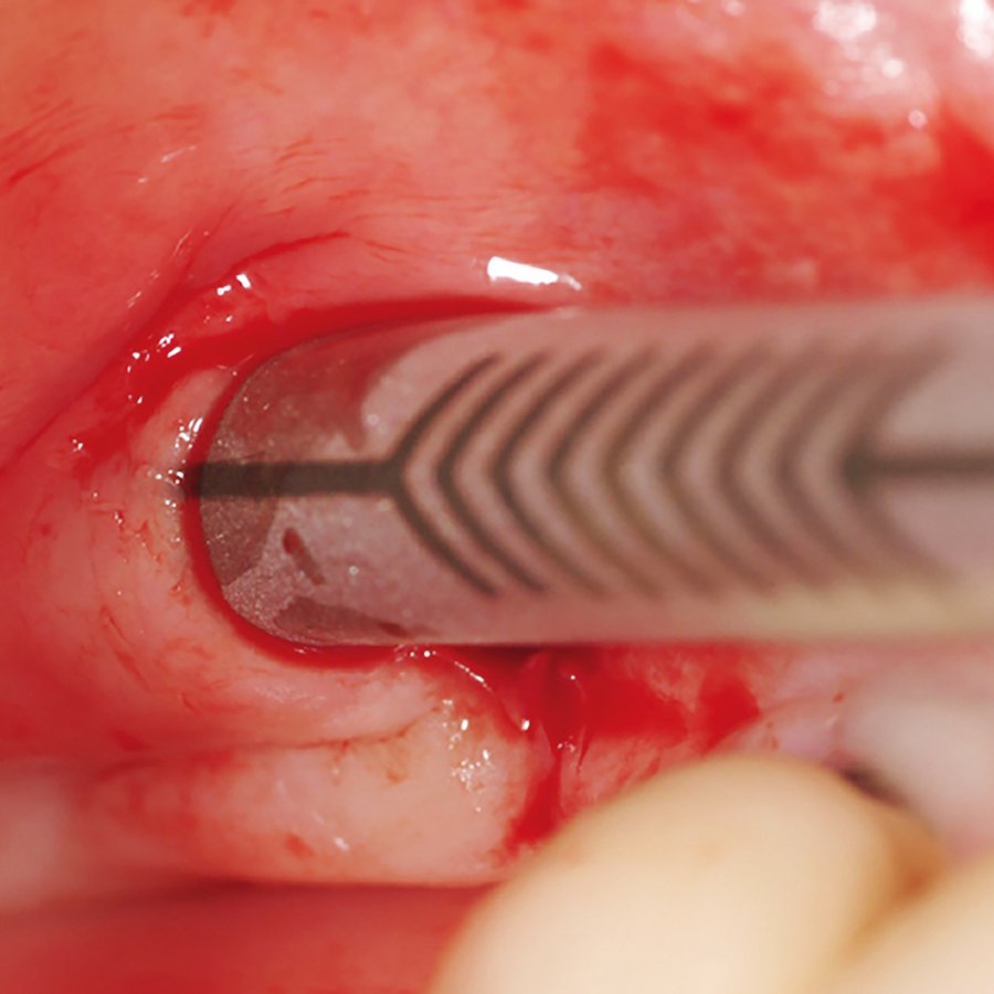 Micross - Geistlich Pharma AG