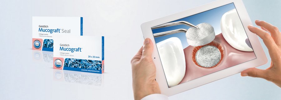 Socket Seal - Geistlich Pharma AG