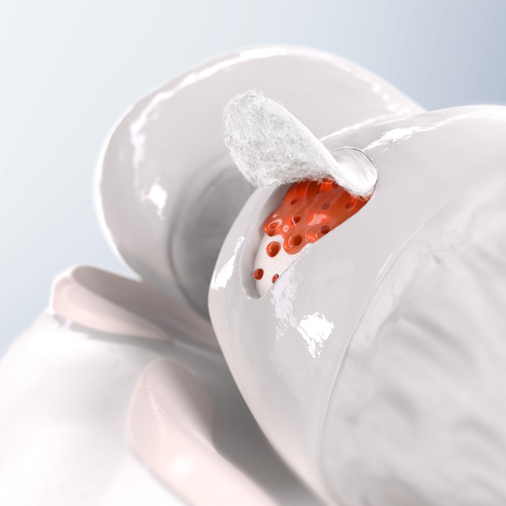 Orthopedic Professionals - Geistlich Pharma AG