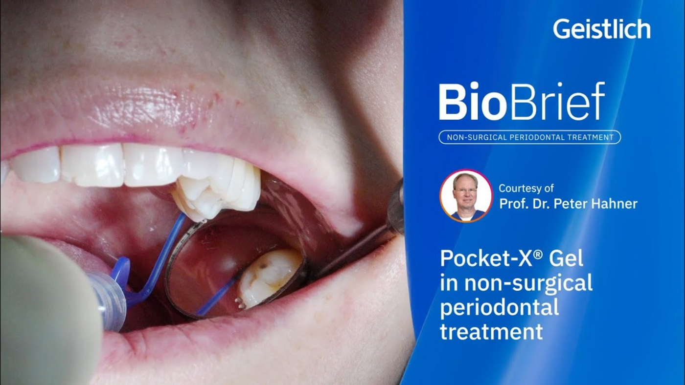 Pocket-X® Gel in non-surgical periodontal treatment - Geistlich Pharma AG