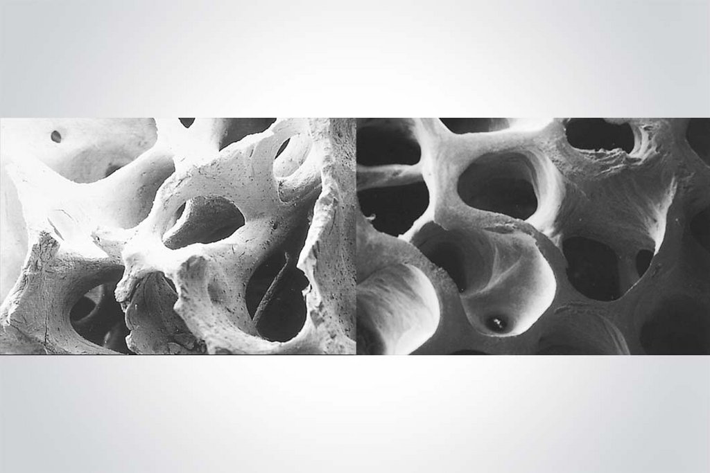 Geistlich Bio-Oss - Geistlich Pharma AG