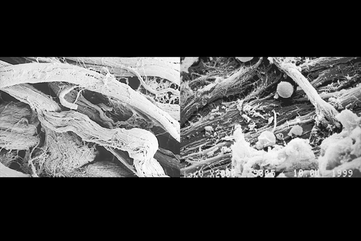 Geistlich Bio-Gide - Geistlich Pharma AG