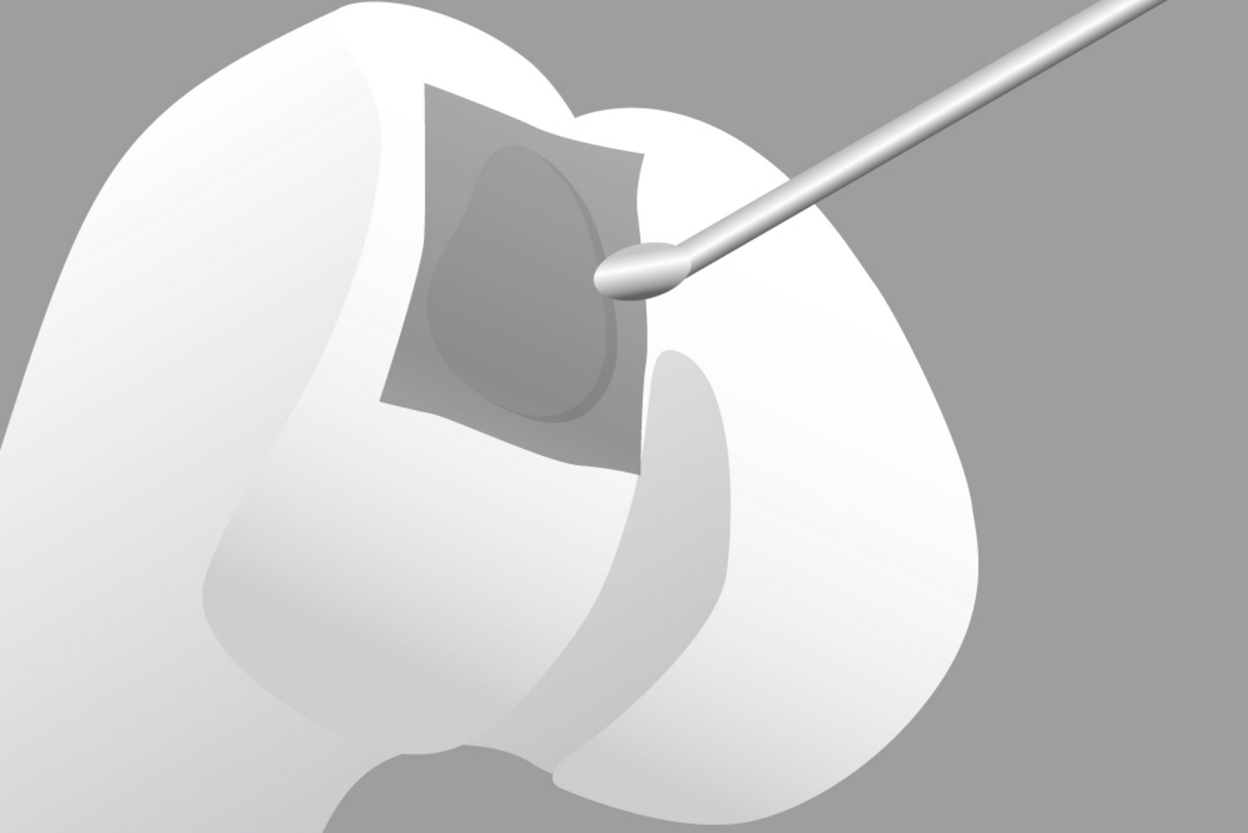 AMIC Chondro-Gide - Geistlich Pharma AG