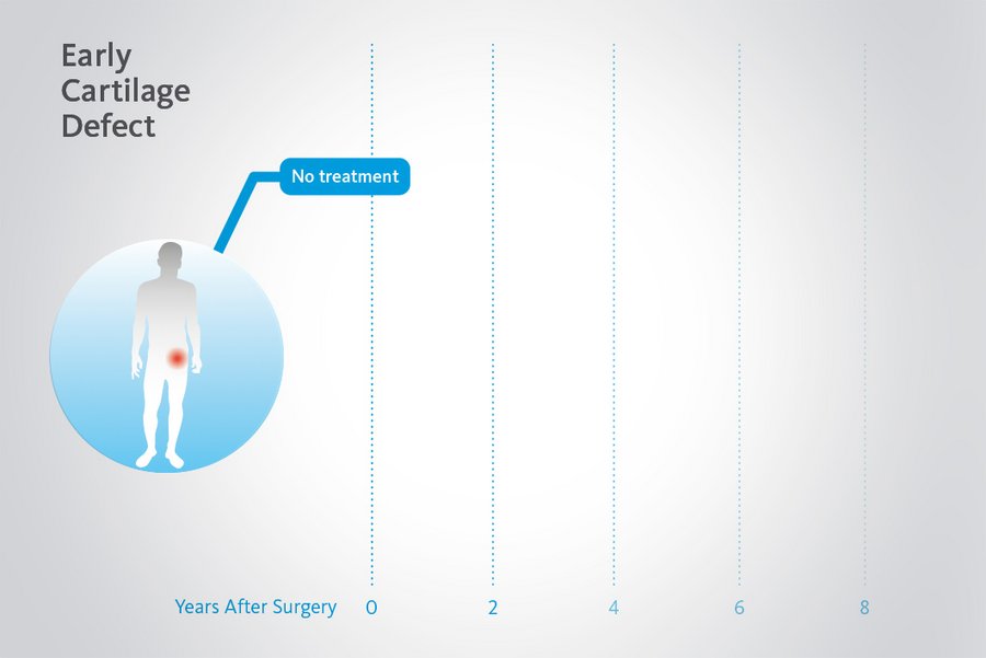 AMIC Hip - Geistlich Pharma AG