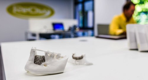 Yxoss CBR® for customized bone augmentation: "A perfect fit ...