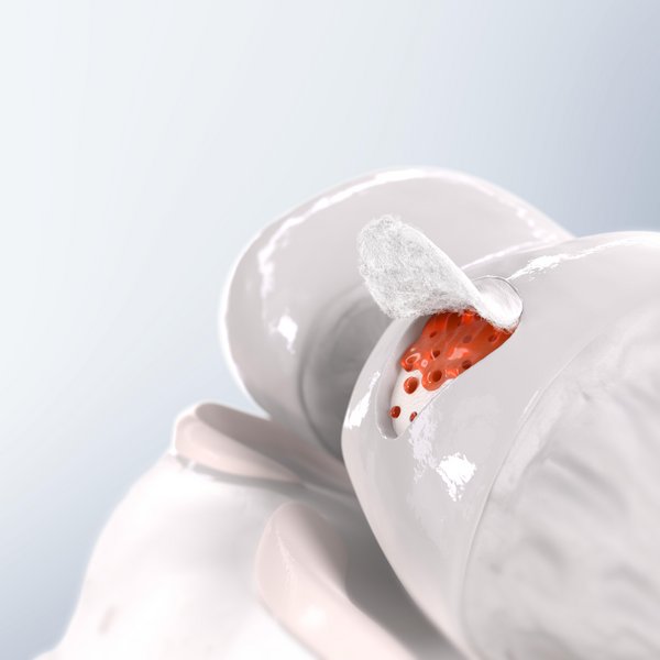 Jubilee Chondro-Gide - Geistlich Pharma AG