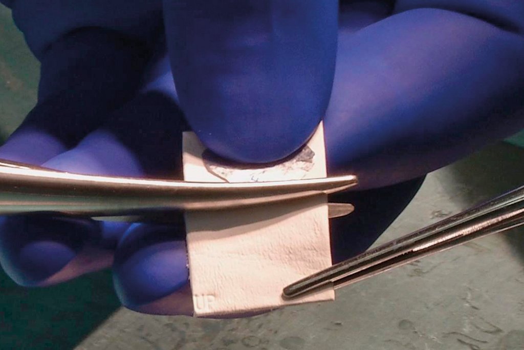 AMIC Knee - Geistlich Pharma AG