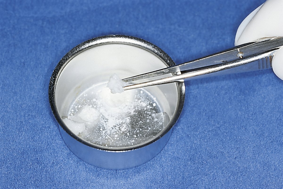 Geistlich Bio-Oss Collagen - Geistlich Pharma AG