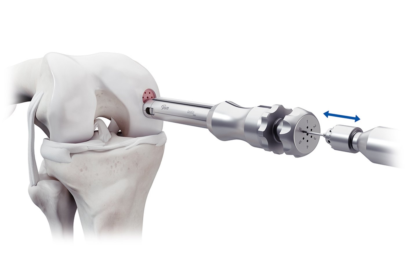 AMIC arthroscopic instruments - Geistlich Pharma AG