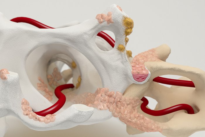 Orthoss - Geistlich Pharma AG