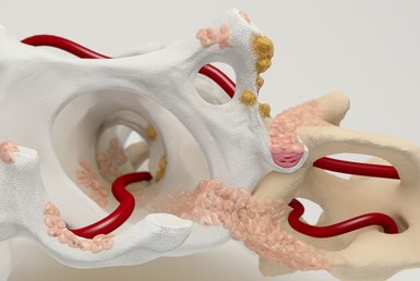 Orthoss - Geistlich Pharma AG