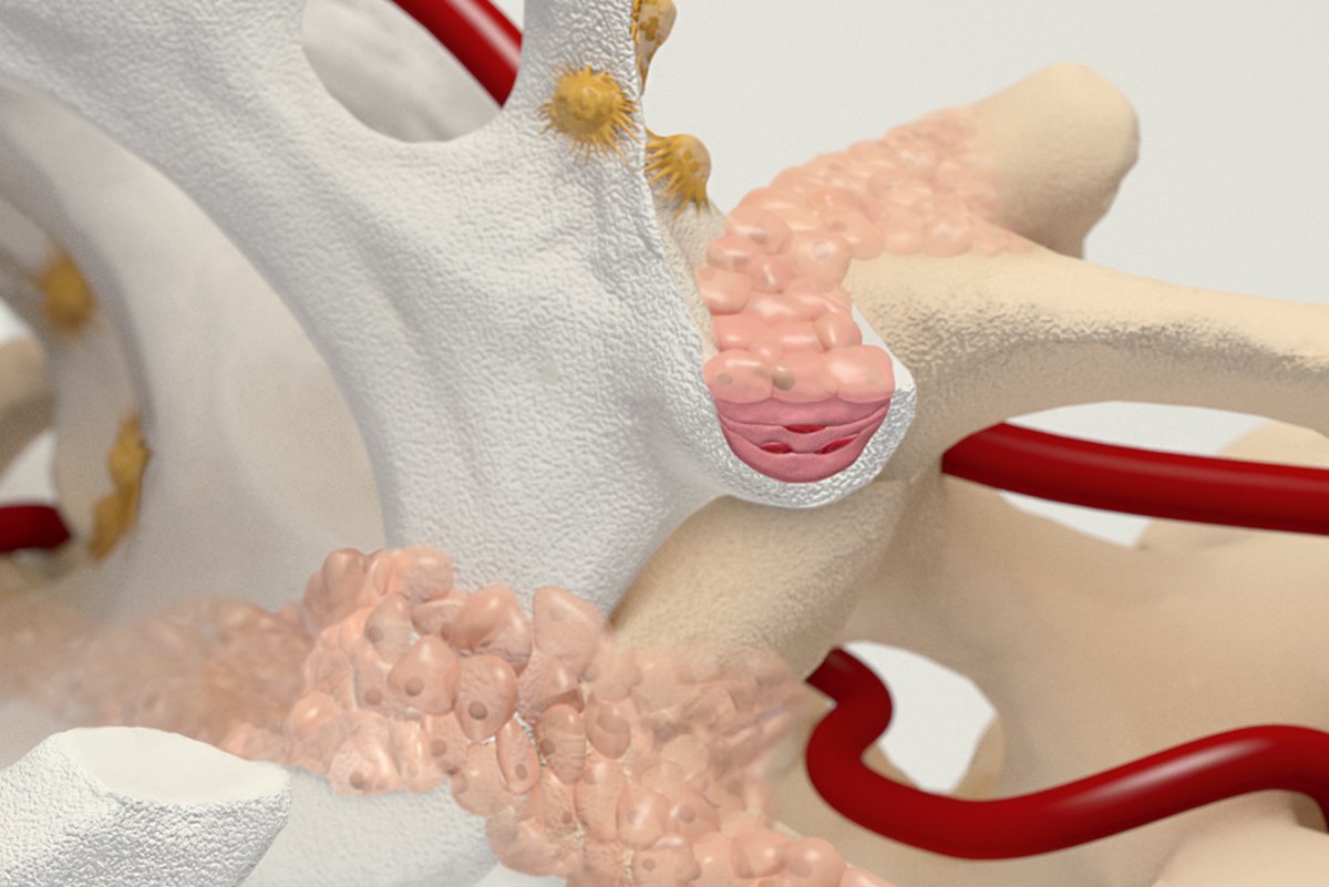 Orthoss - Geistlich Pharma AG