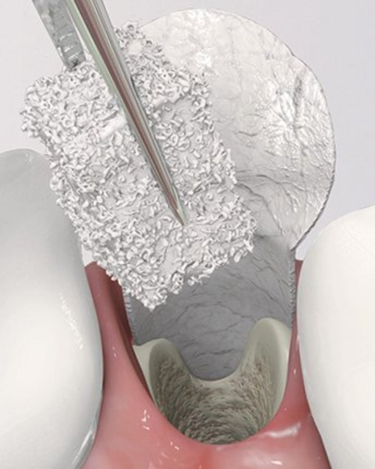 Dental Professionals - Geistlich Pharma AG