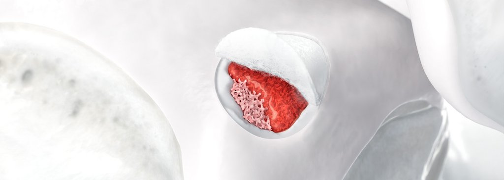 AMIC Talus - Geistlich Pharma AG