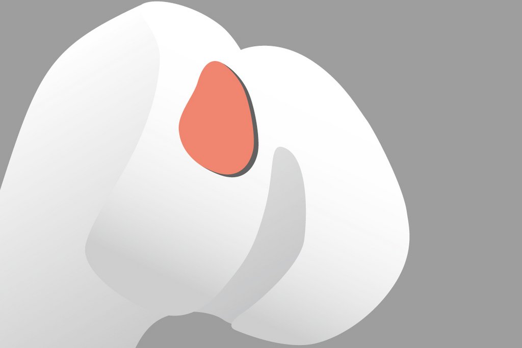 AMIC Chondro-Gide - Geistlich Pharma AG