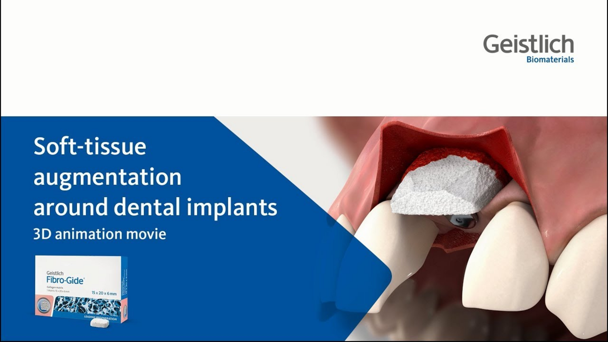 Fibro-Gide - Geistlich Pharma AG