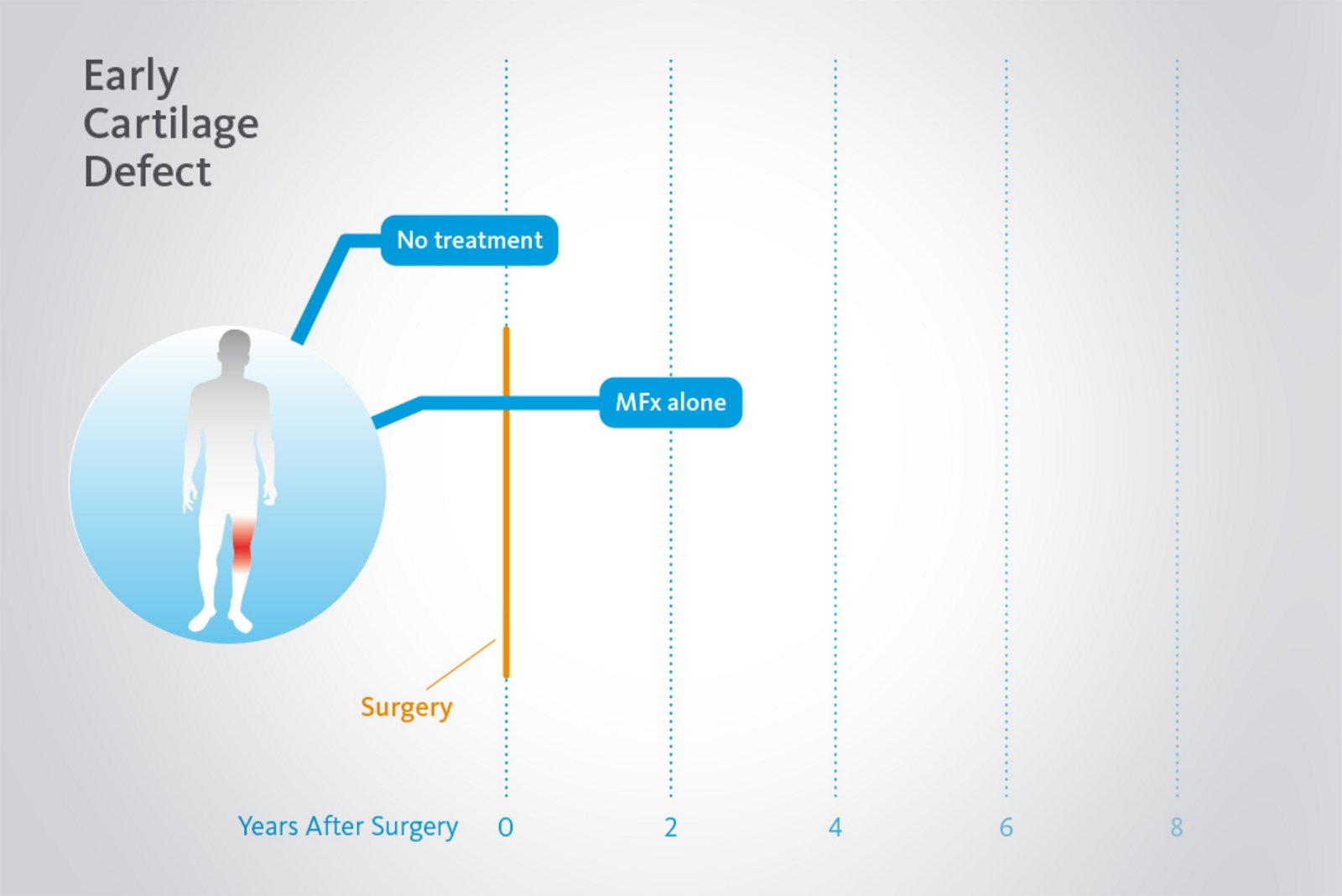AMIC Knee - Geistlich Pharma AG