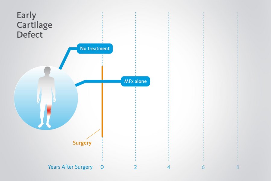 AMIC Knee - Geistlich Pharma AG