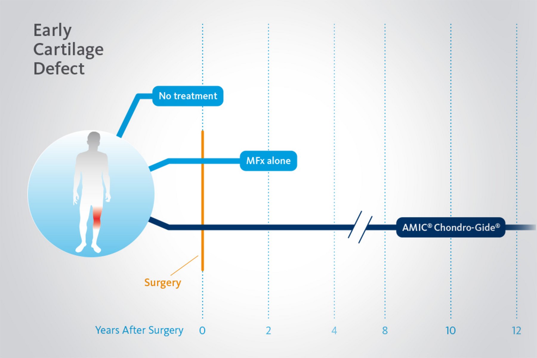 AMIC Knee - Geistlich Pharma AG