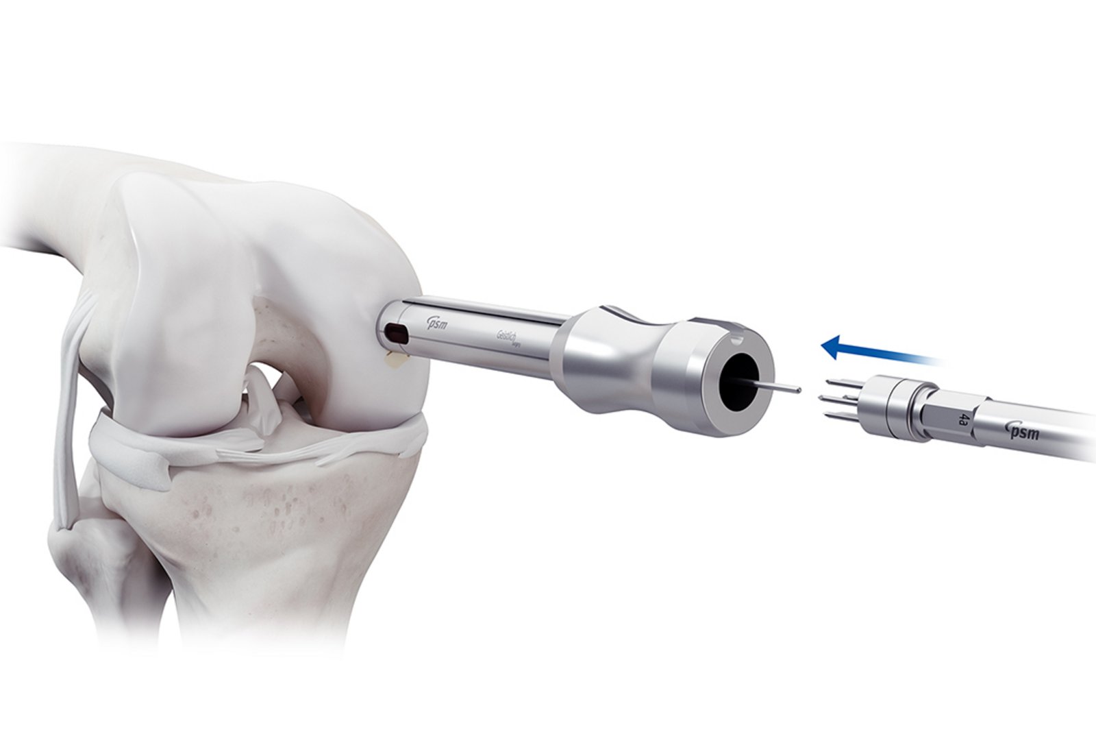 AMIC arthroscopic instruments - Geistlich Pharma AG