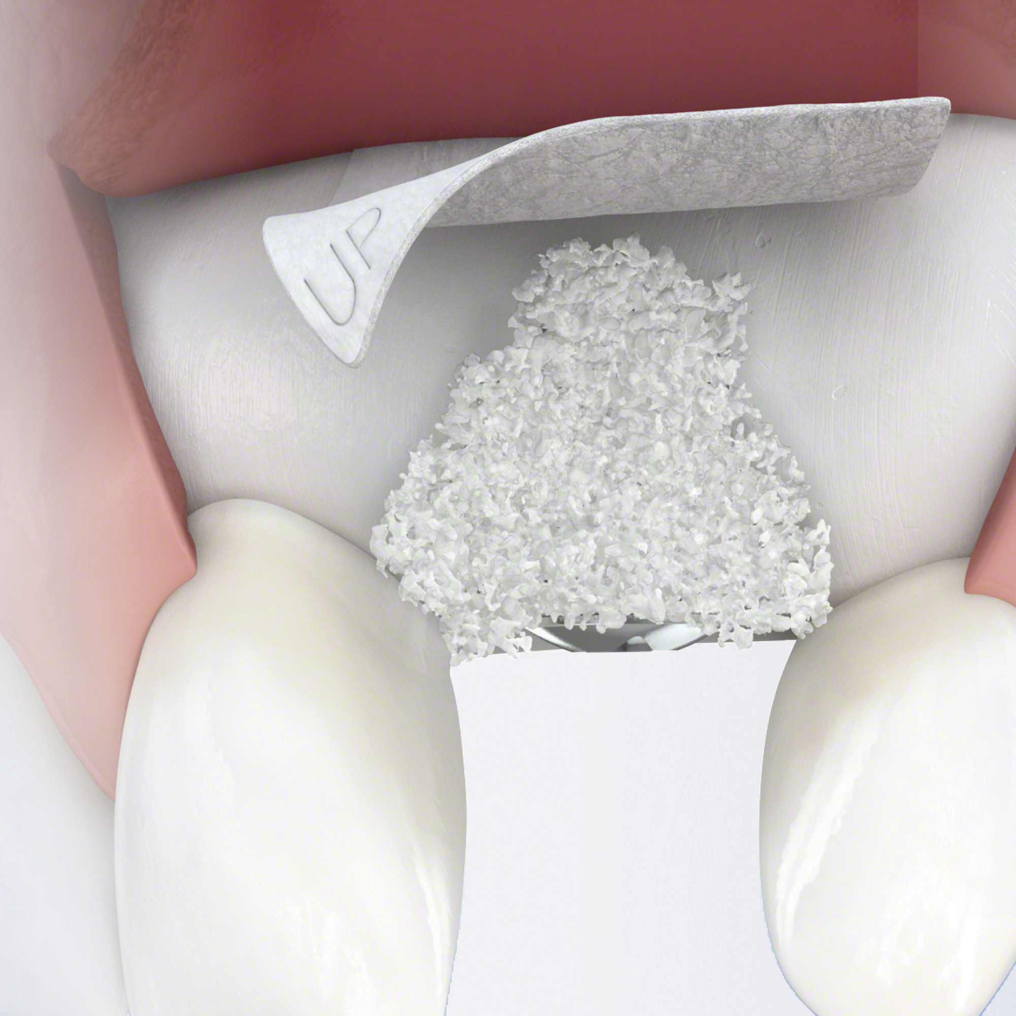 GEM21S - Geistlich Pharma AG