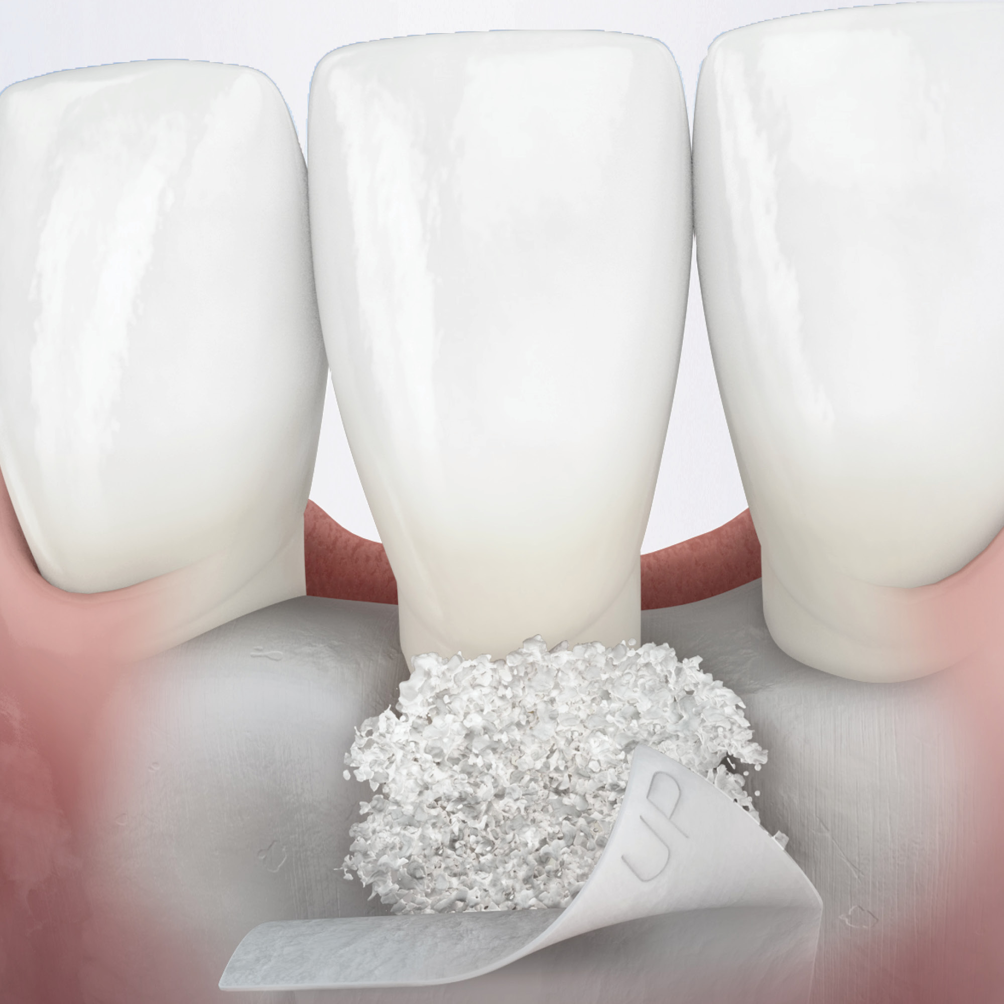 GEM21S - Geistlich Pharma AG