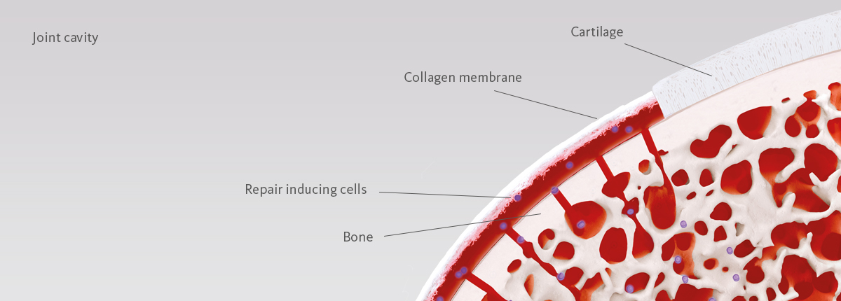 About AMIC - Geistlich Pharma AG
