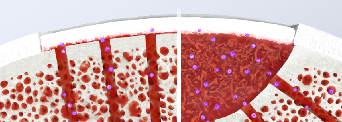 AMIC Chondro-Gide - Geistlich Pharma AG