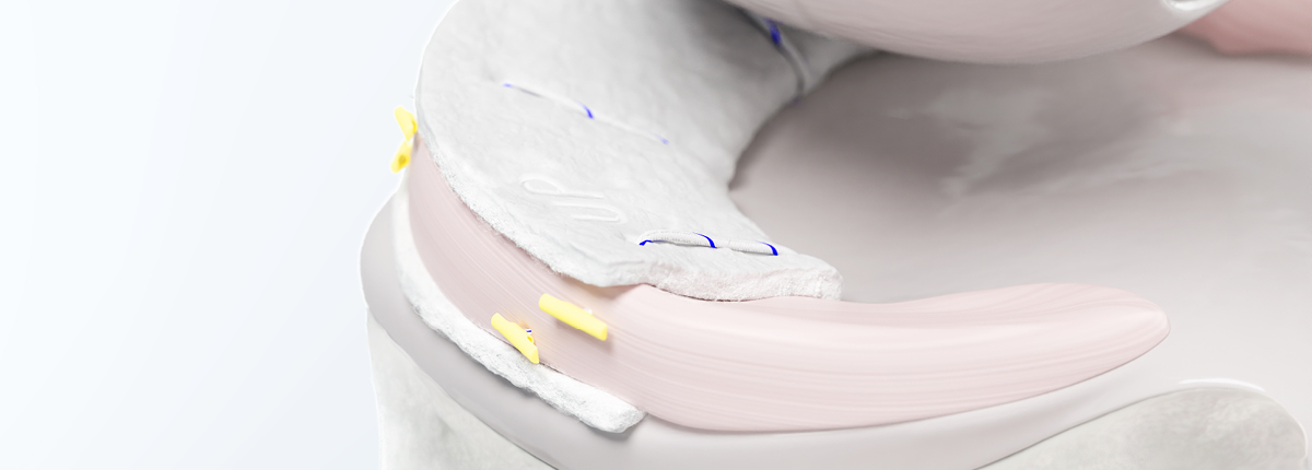 AMMR - Geistlich Pharma AG