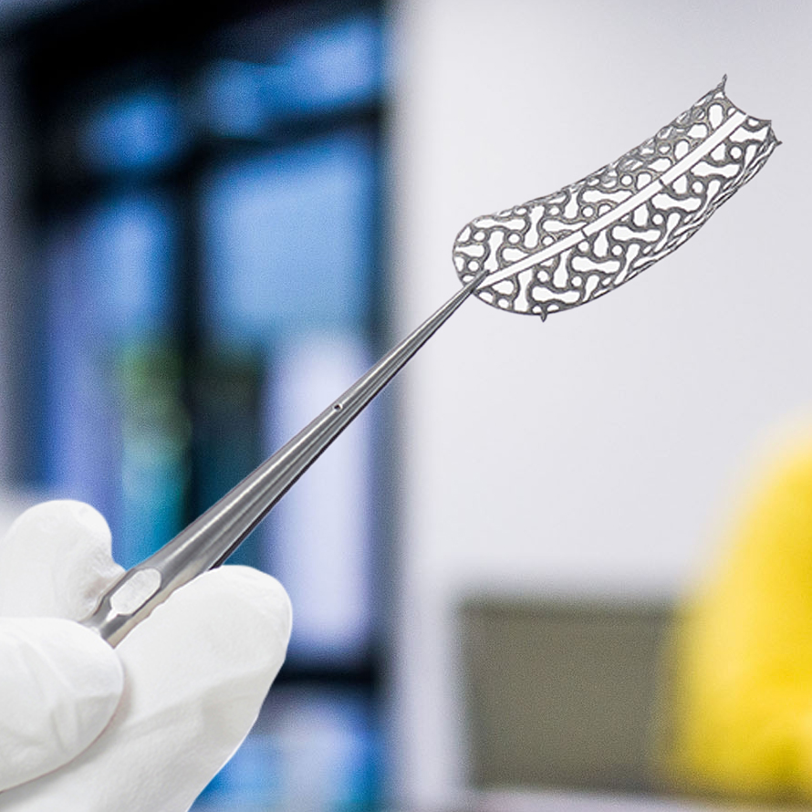 Yxoss CBR® for customized bone augmentation: "A perfect fit ...